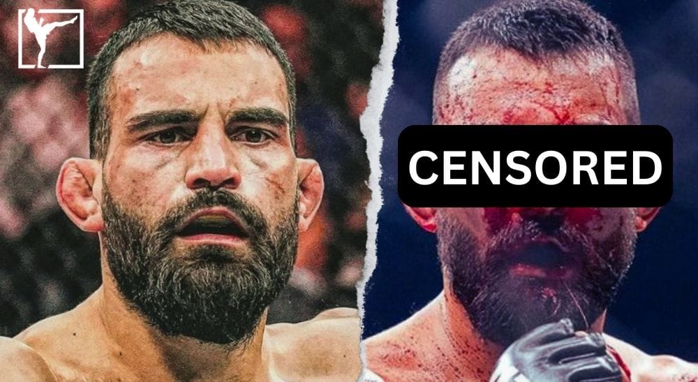 Before/after photos of Benoit Saint-Denis' battered face